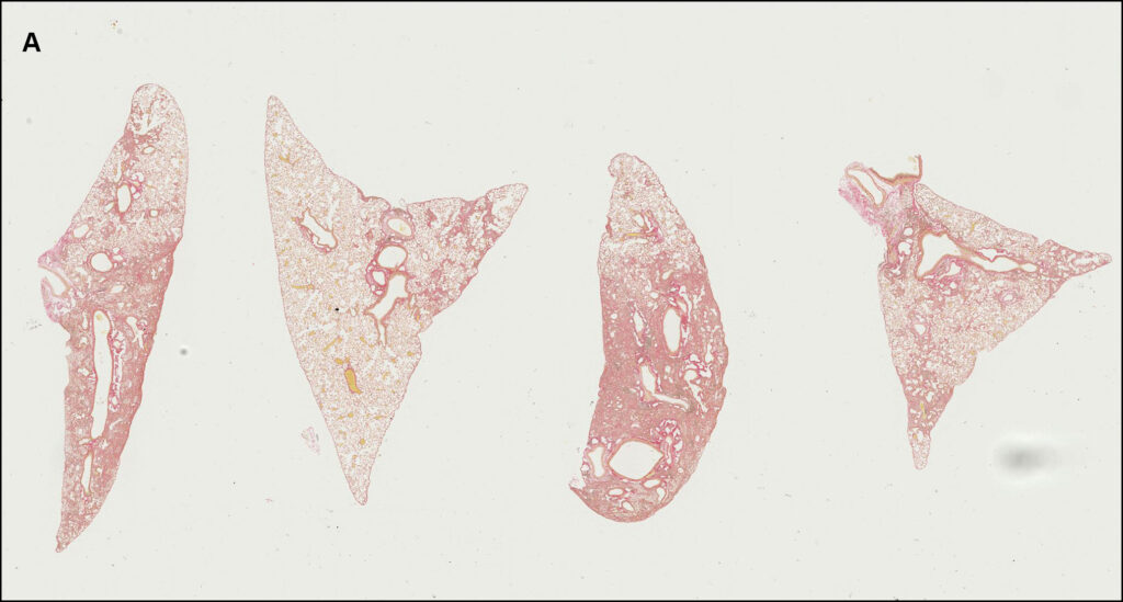 The Role of Pre-Clinical Bleomycin Models in IPF Drug Development ...