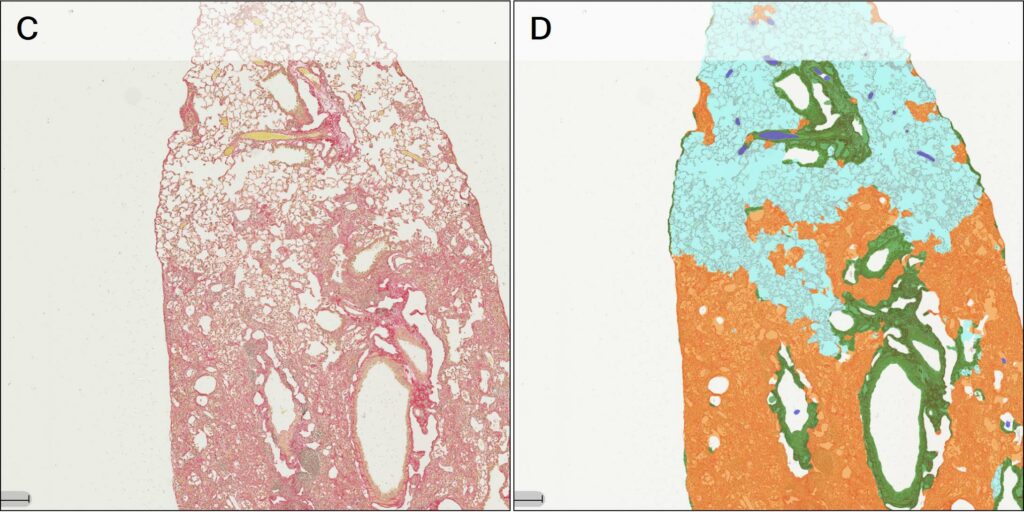 The Role of Pre-Clinical Bleomycin Models in IPF Drug Development ...
